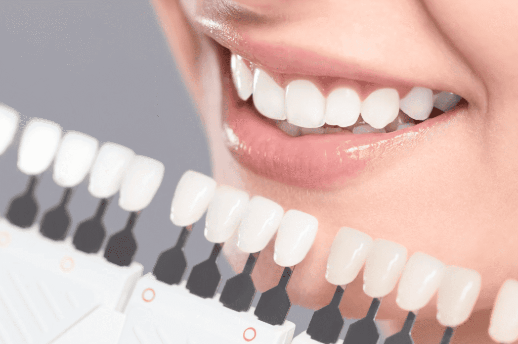 Blue Light Teeth Whitening: The Benefits, Process, And Dentist ...